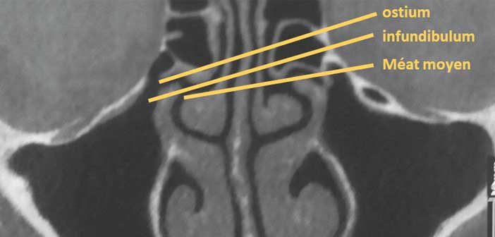 Comment faire un drainage des sinus ? - Le Portail de la Santé